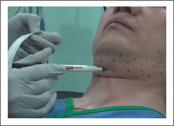 Injection Lipolysis by Dr. Apratim Goel