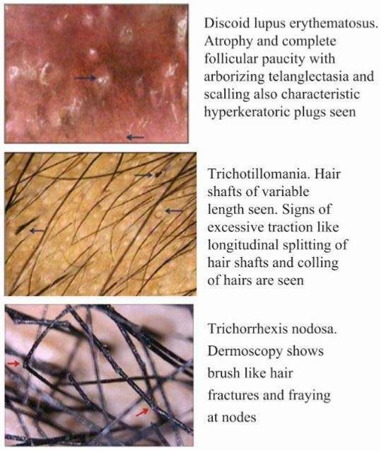 Trichology: An Overview By Dr. Archana Parab